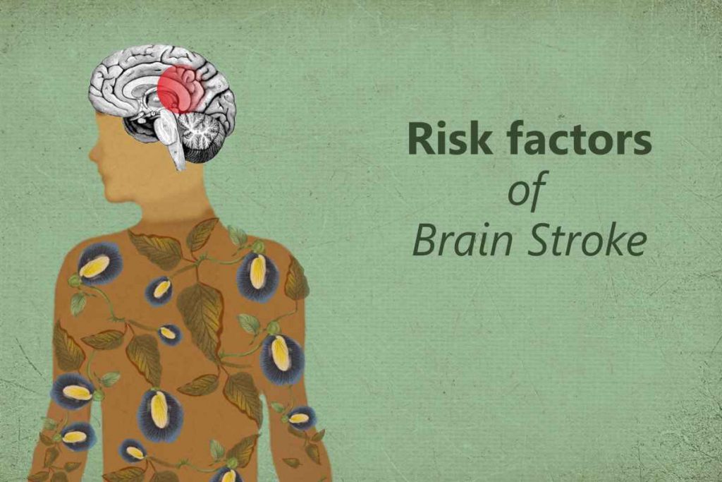 Know Your Risk Factors for Brain Stroke